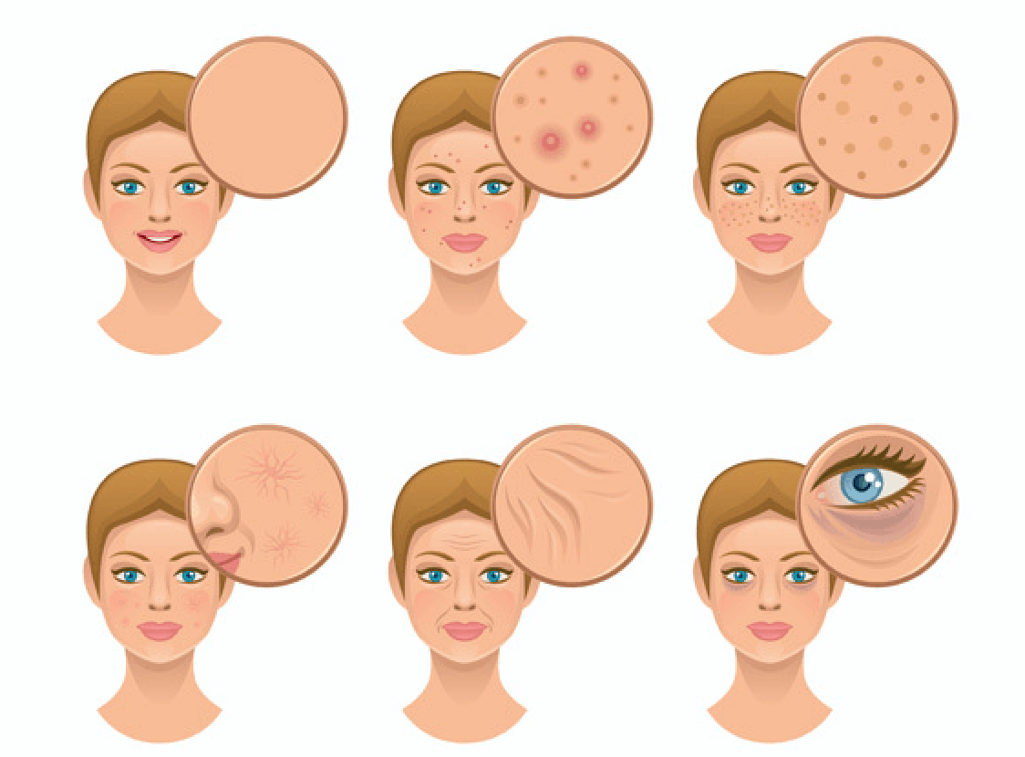 Conoce las enfermedades de la piel que ATACAN más a las MUJERES | Familias